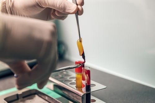 What Is L-PRF Therapy | Leukocyte-Platelet Rich Fibrin