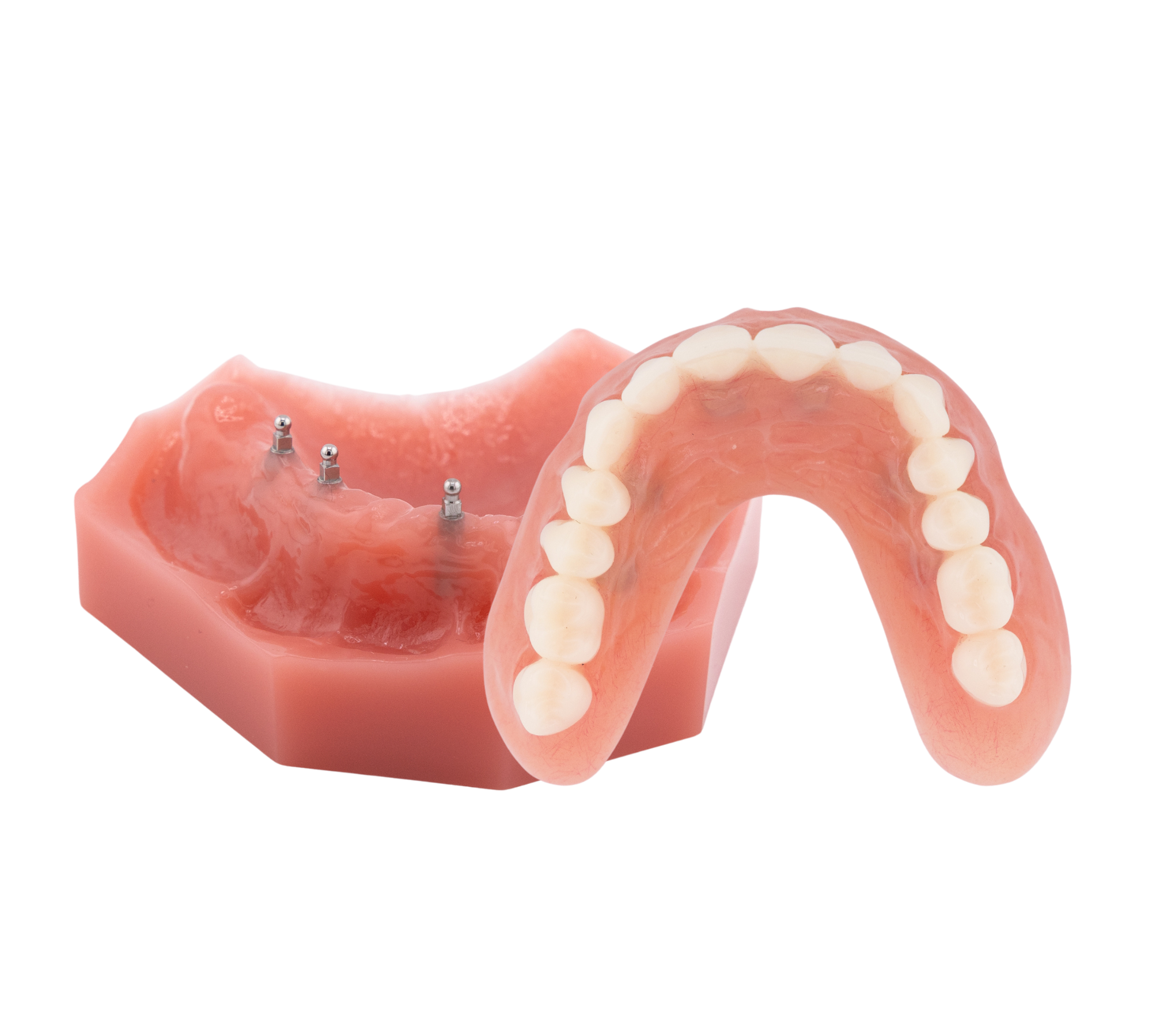 What Is a Snap-On Denture and How Does It Work?